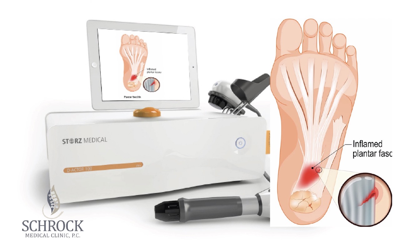 Medical Wave Therapy - Schrock Medical Clinic